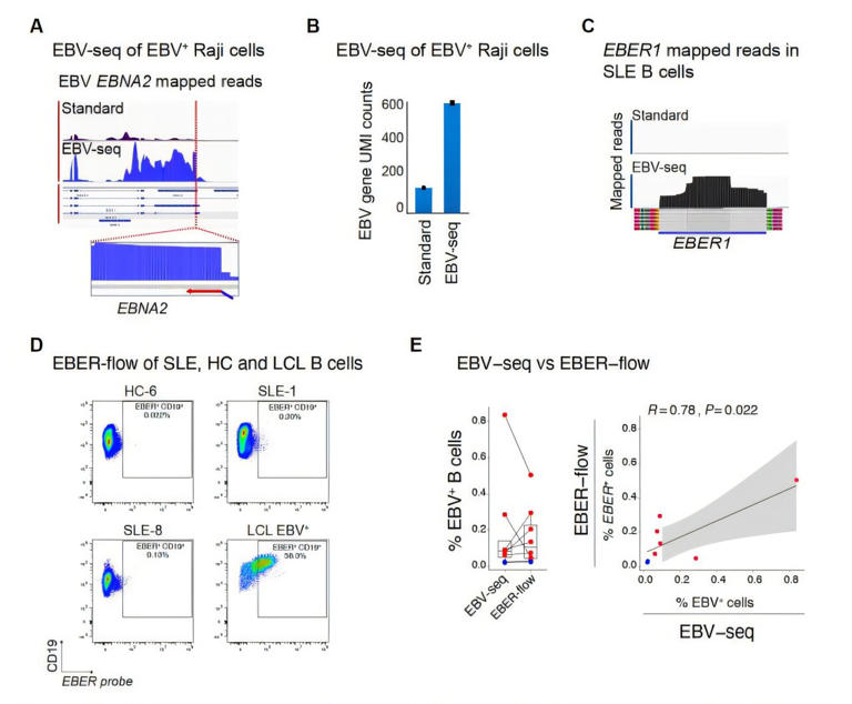 Scientists tie lupus to a virus nearly all of us carry