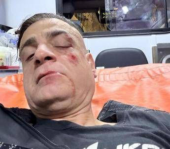 Cicalone, lo youtuber aggredito in metro a Roma: "Infami veri"