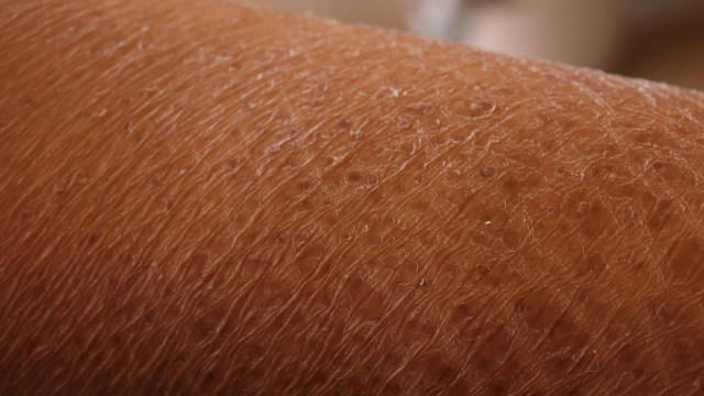 Scientists make disturbing discovery while studying human skin: 'May ...