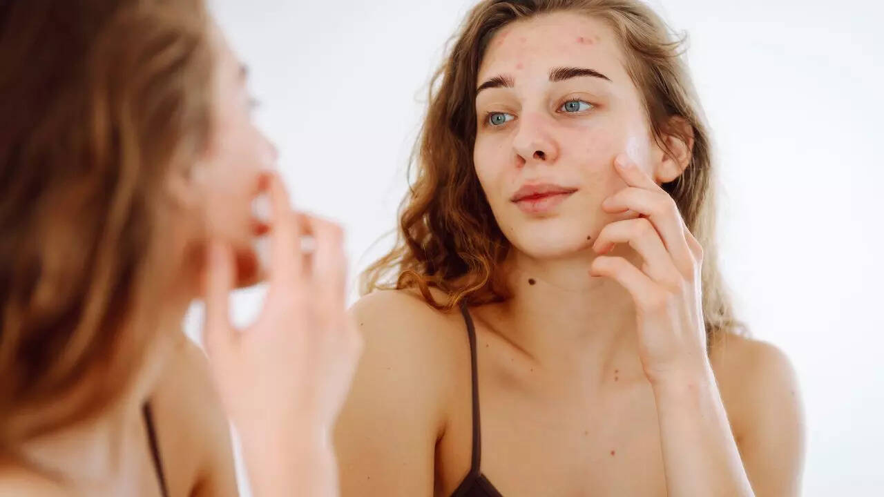 Understanding skin fatigue: How lack of sleep and stress affect your ...