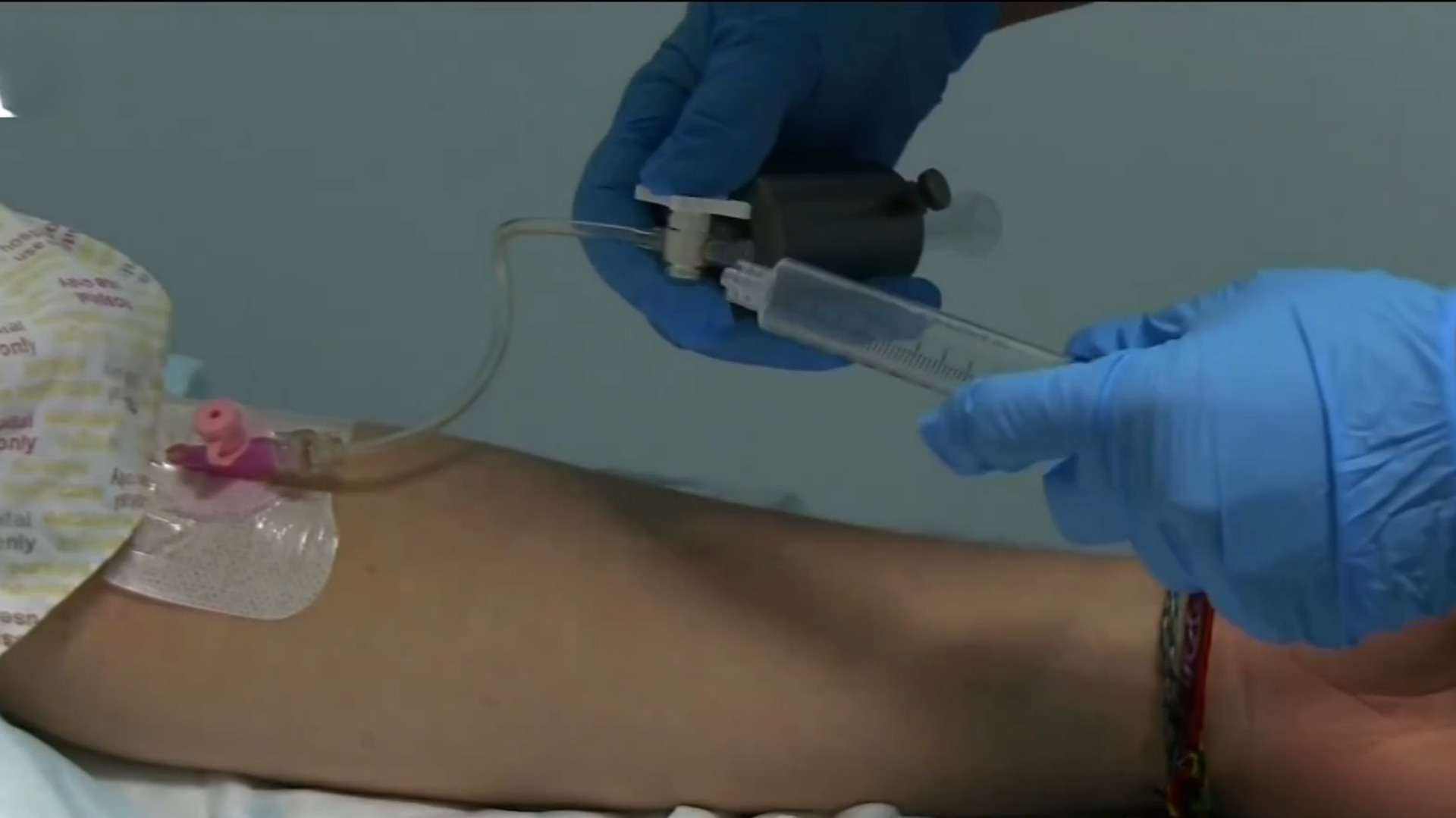 PBS to cover rare blood cancer treatment