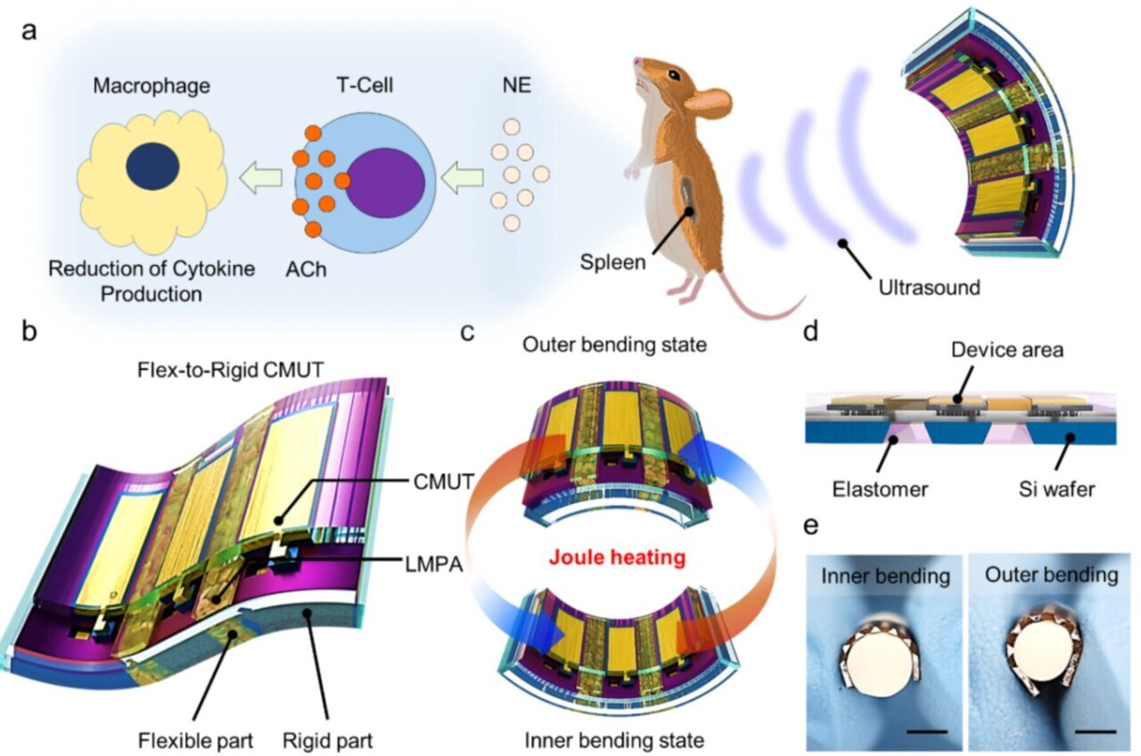 Wearable ultrasound sensor delivers noninvasive treatment with ...