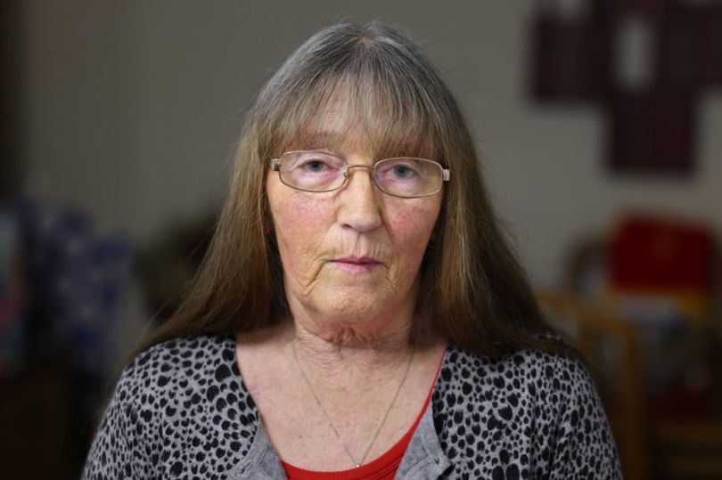 Merseyside nan living in fear after pacemaker fails twice