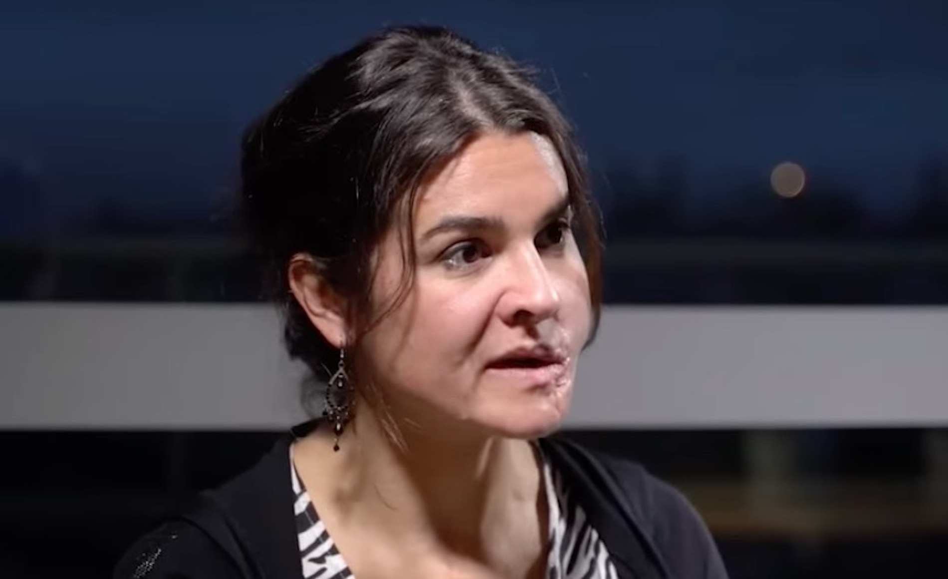 Attentats du 13 novembre 2015 : "J'ai subi plus de 50 opérations ...