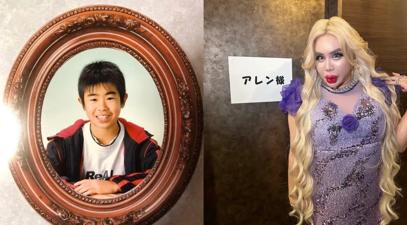 Japanese Man's 200 Surgeries After Bullying