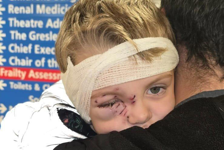 Yorkshire five-year-old mauled by dog in park - leaving mother to fear ...