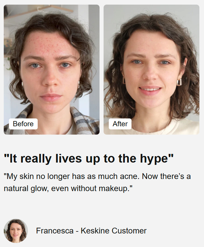 LED mask promises salon-worthy skin at home