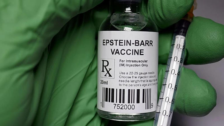 Common virus that causes mono identified as likely trigger for lupus ...