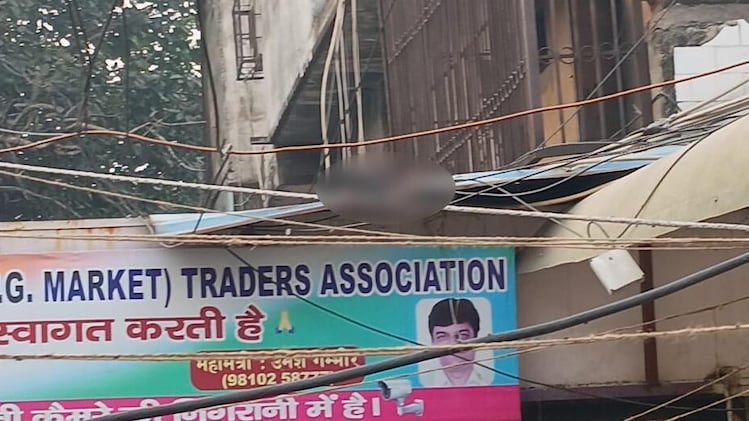 Red Fort blast: Forensic team recovers severed forearm 300m away from ...