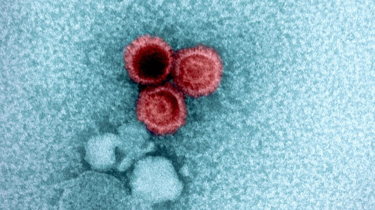 Lupus Linked To Virus That Over 95 Percent Of Us Carry – And Now We ...