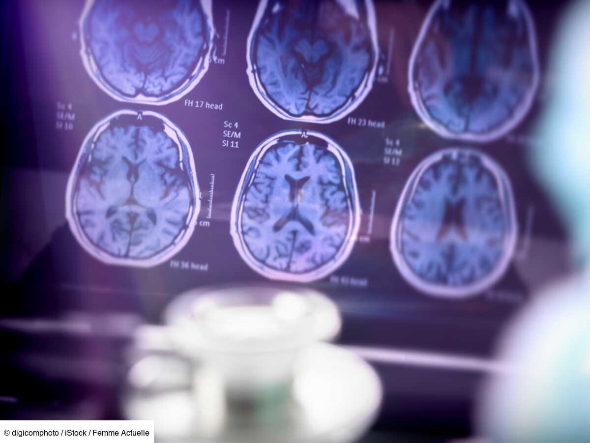 “Avant l'apparition des premiers symptômes” : ce calculateur détecte la ...