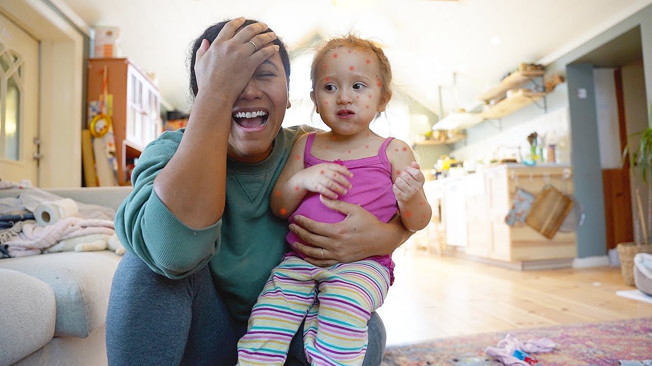 How we take care of our daughter with chicken pox