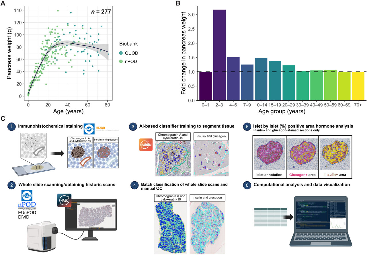 Why type 1 diabetes is more aggressive in young children