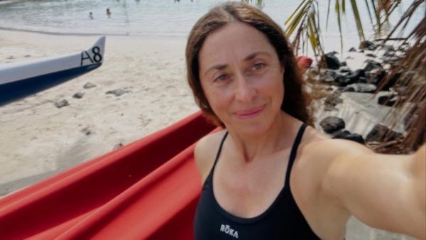 "Me abrieron el brazo por completo": el drama que golpea a triatleta ...