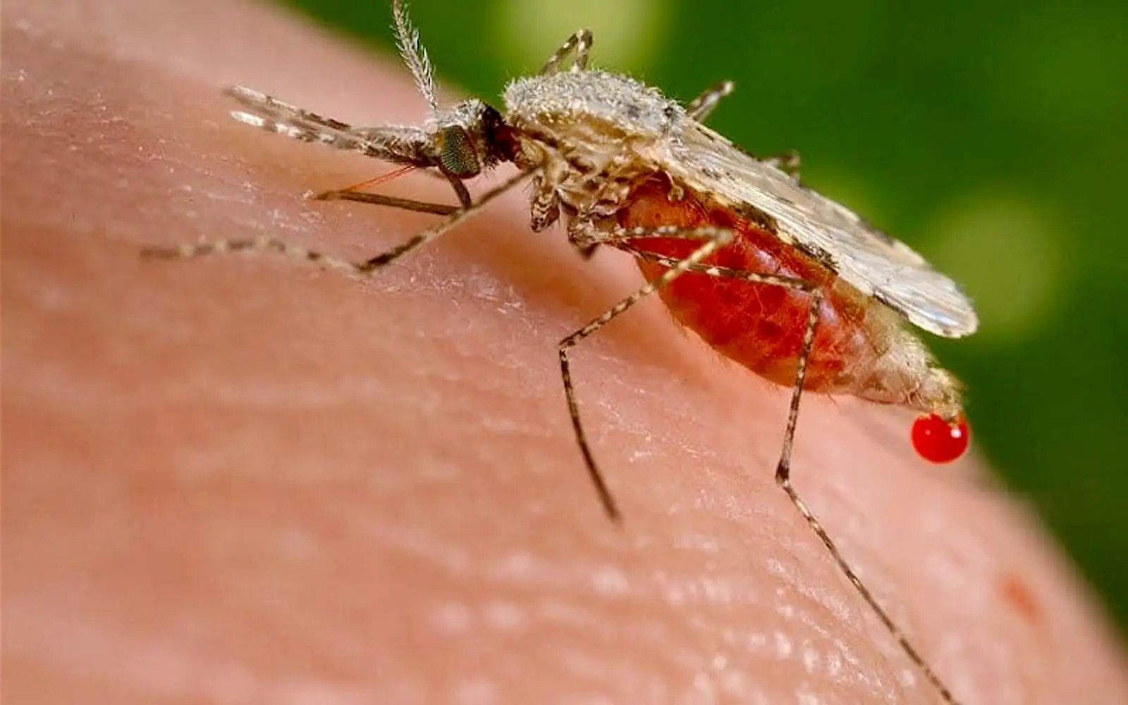 Terengganu sees spike in malaria cases involving migrants