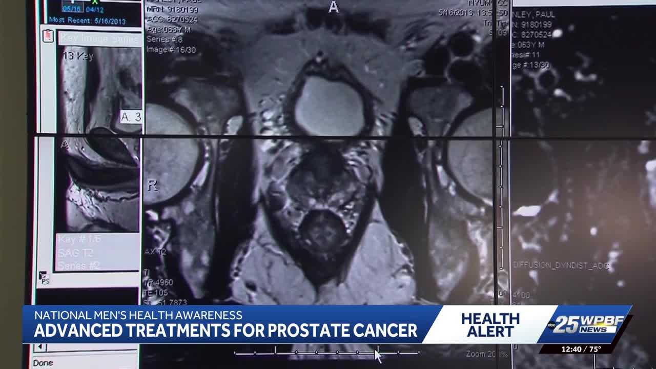 Men's Health Awareness: Advanced treatment for prostate cancer