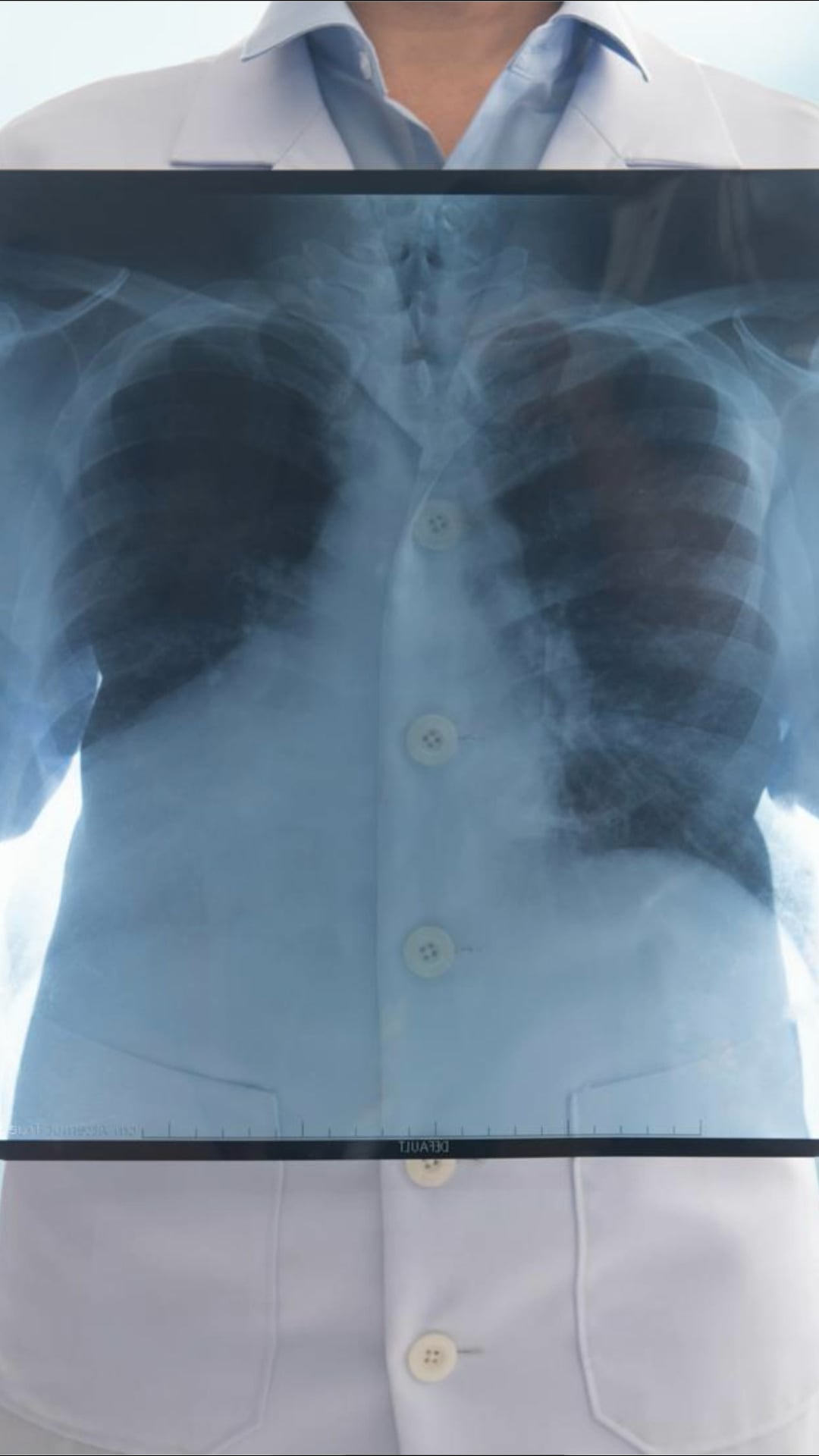 How To Spot The Early Signs Of Lung Cancer.