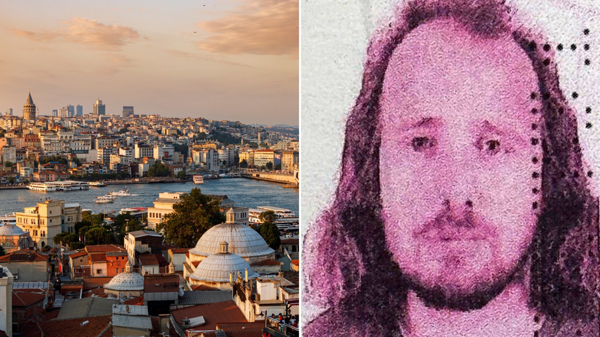 Brit dies after hair transplant in Turkey gone wrong