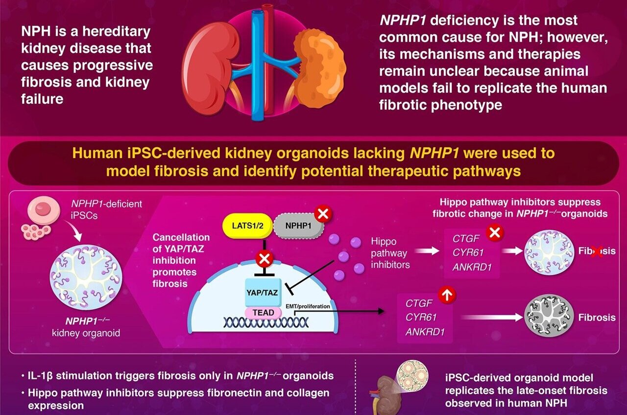 Kidney organoids uncover Hippo signaling pathway as a therapeutic ...