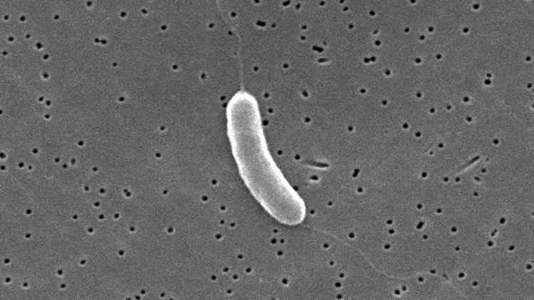 Case of flesh-eating bacteria reported in Polk County, state health ...