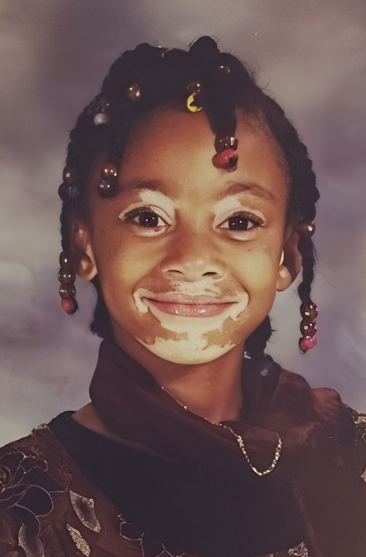 Meet Winnie Harlow, the Vitiligo Supermodel Breaking Beauty Rules Since ...