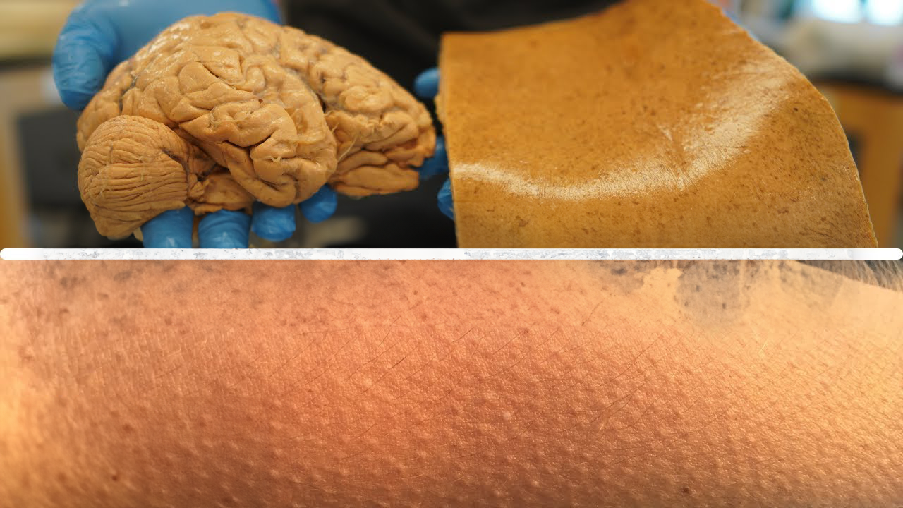 The Science Behind Goosebumps
