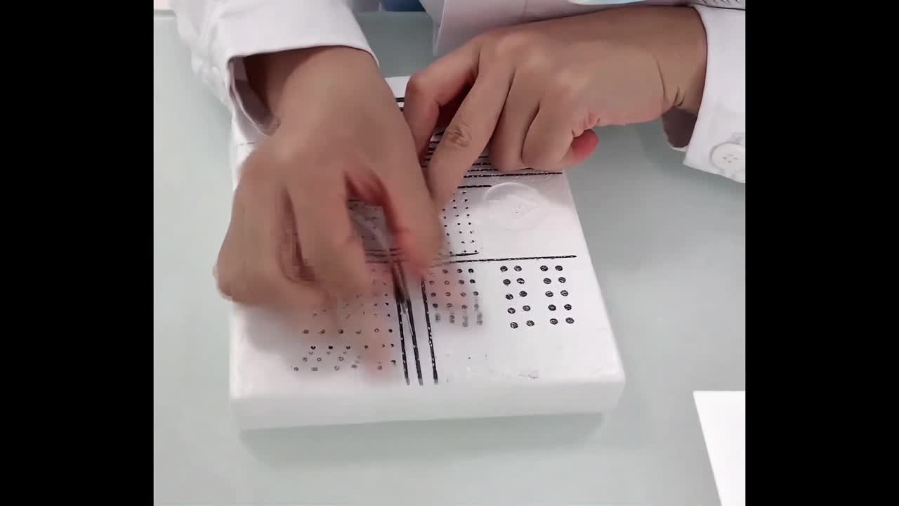 Nurse performs 'flying needle' technique so patients won't feel a thing