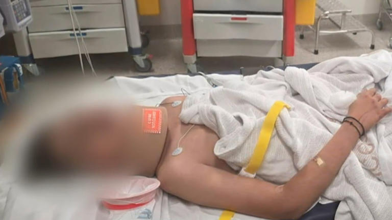 Boy left seriously injured after 'disgusting' e-bike theft