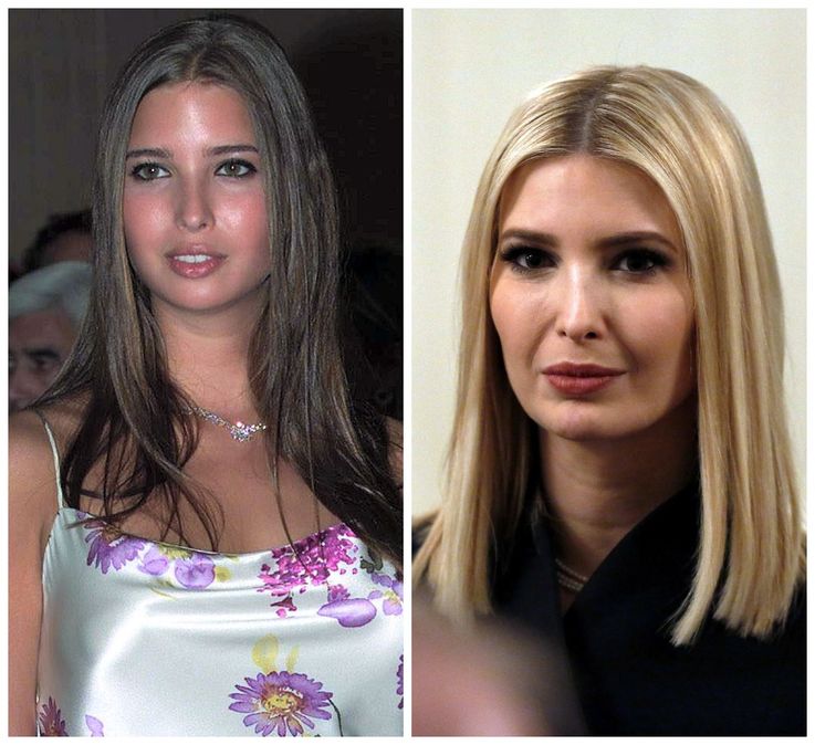 Mar-a-Lago yüzü trendi yükselişte