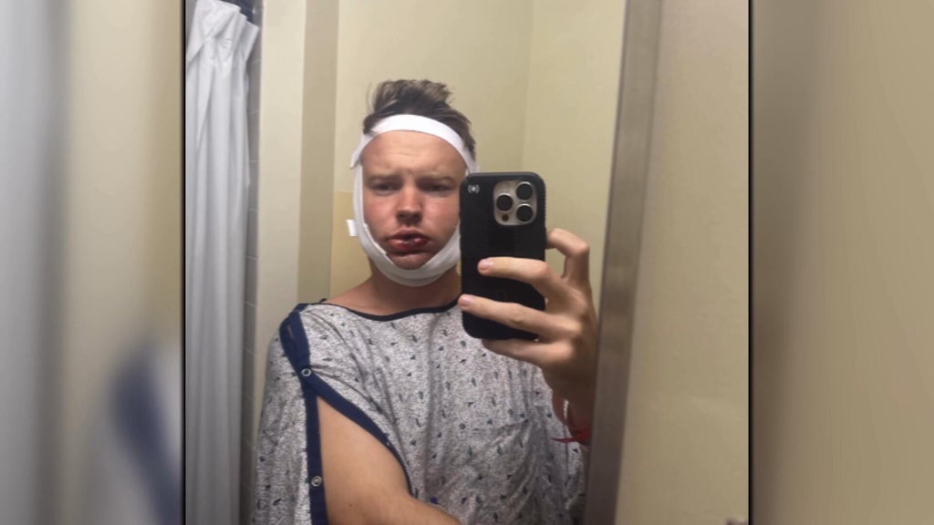 Arrest made in unprovoked attack on 22-year-old in Philadelphia, police ...