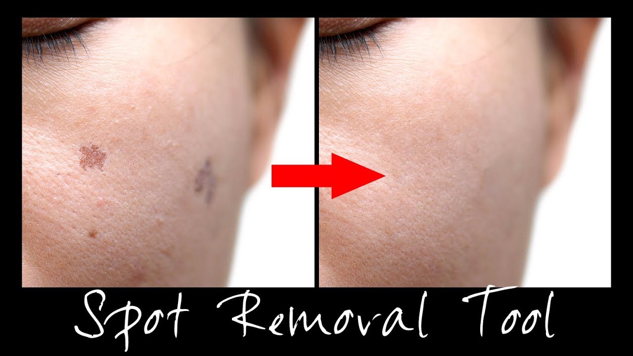 Photoshop CC quick tip: The spot removal tool in Camera Raw