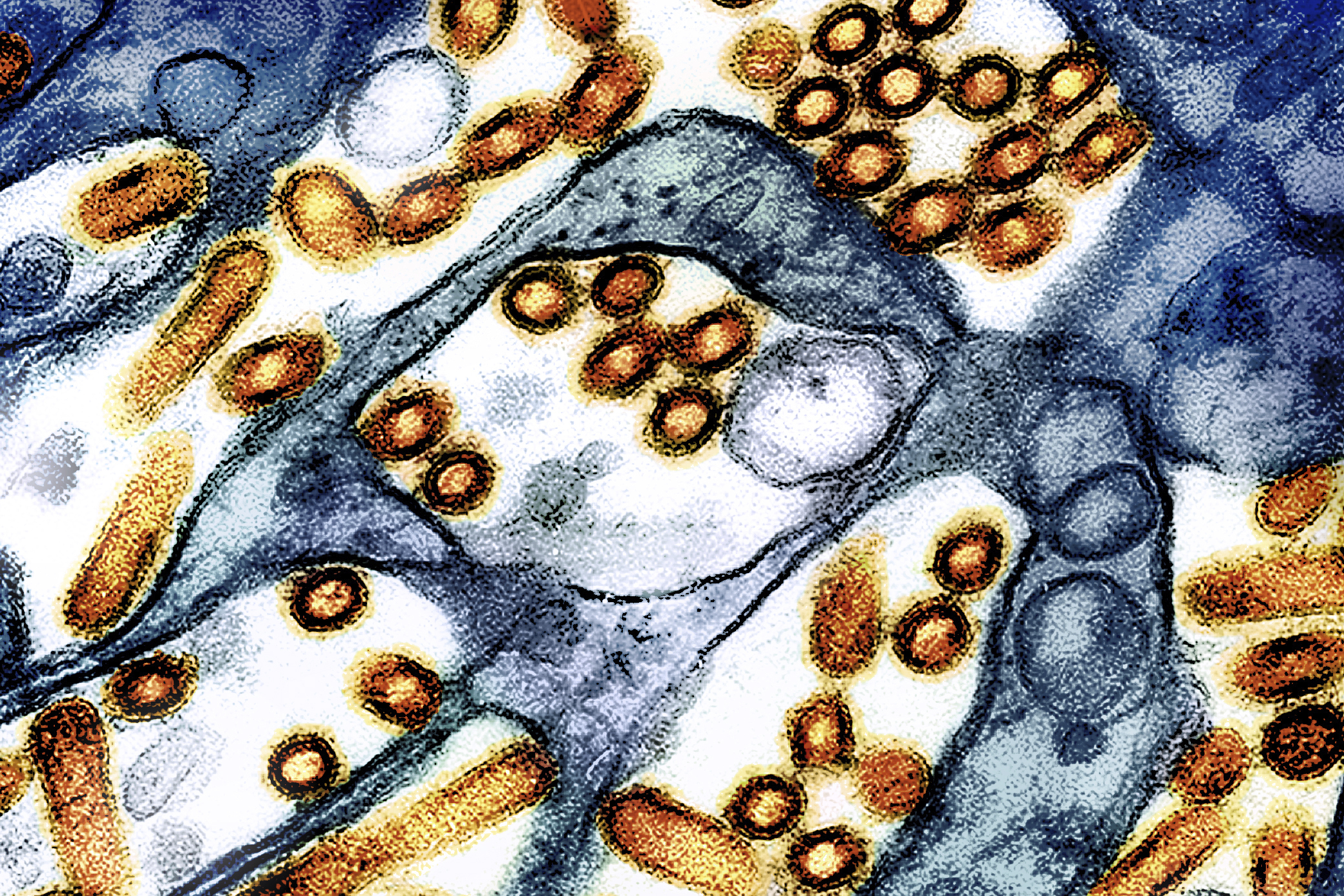First U.S. case of human bird flu in 9 months confirmed in Washington state