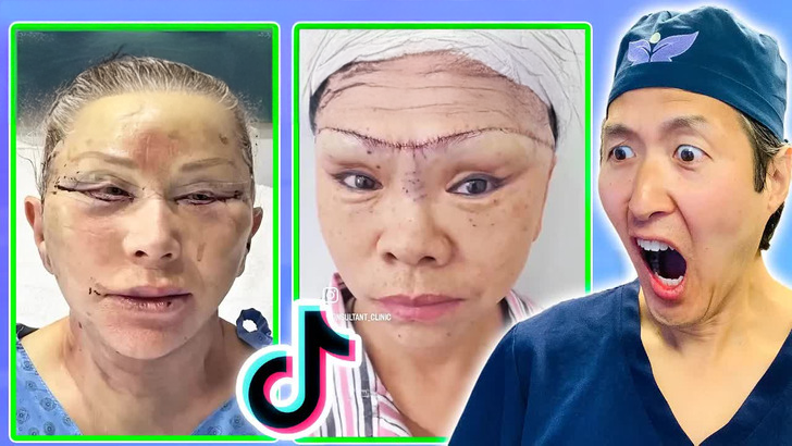 Plastic Surgeon Reacts to Wild Skibidi TikToks