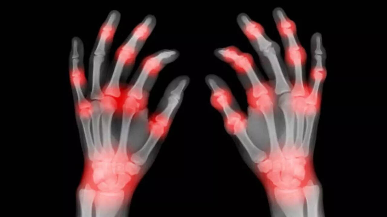 Typing too long? 3 exercises for stiff and painful hands