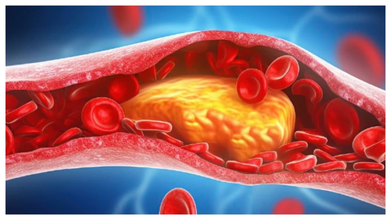 8 things to do to reduce bad cholesterol naturally and protect your heart