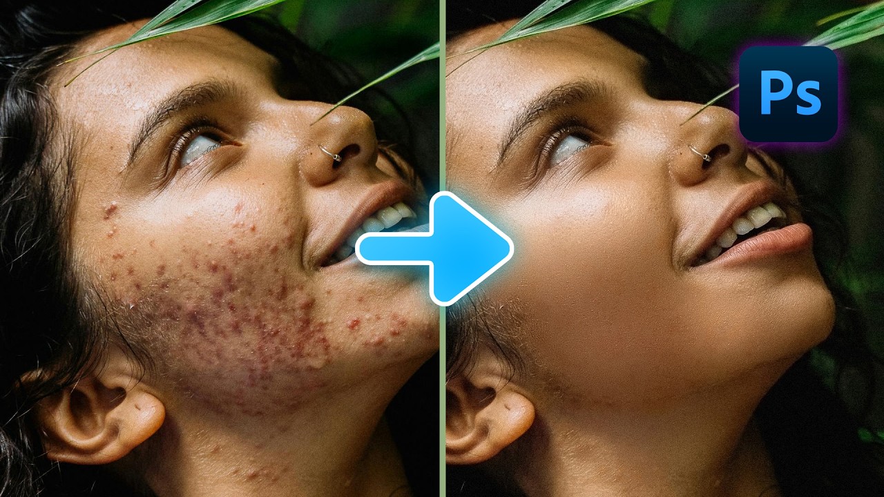 How to remove bad acne in Photoshop