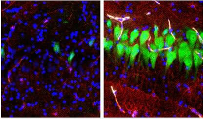 From Frankenstein to Reality: Five Experiments Where Science Crossed ...