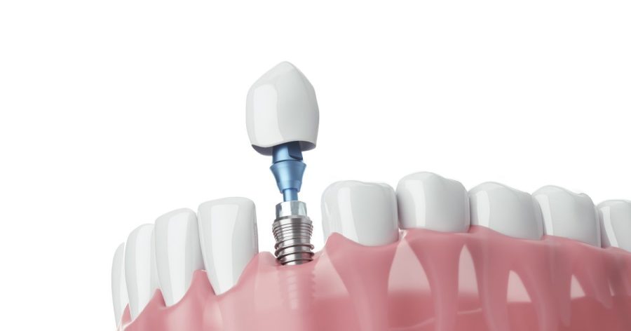 Why do people have baby teeth and adult teeth?