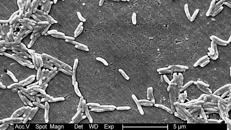 3rd person dies after 'intentional' 12-car Las Vegas crash, prosecutors say