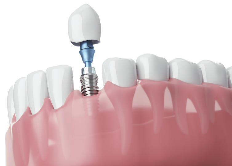 Why do people have baby teeth and adult teeth?