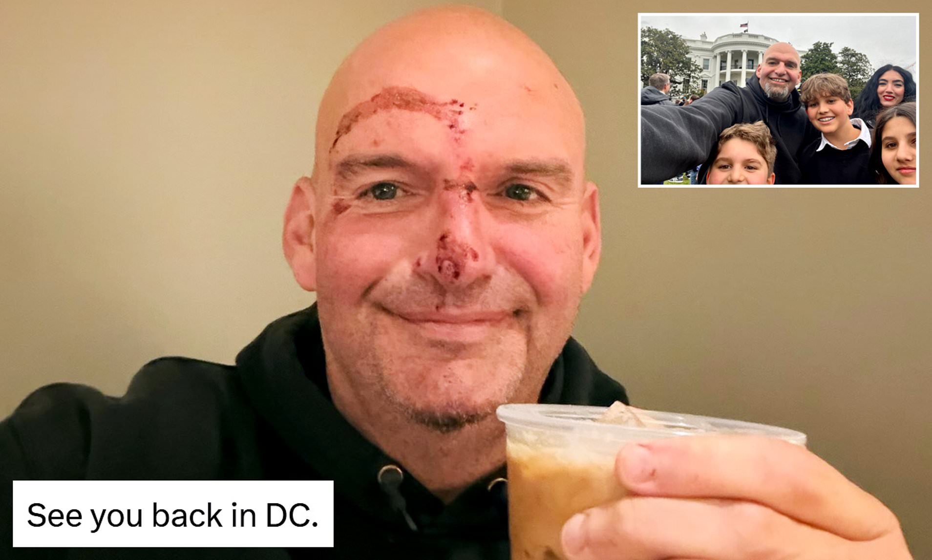 Fetterman shares smiling selfie of stitched up face after heart problem ...