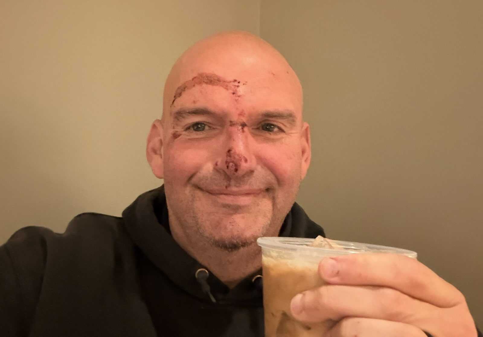 Sen. Fetterman says he received 20 stitches, is now fully recovered ...