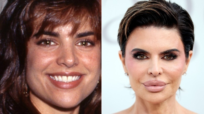 Before & After Photos Of Lisa Rinna's Plastic Surgery Transformation ...