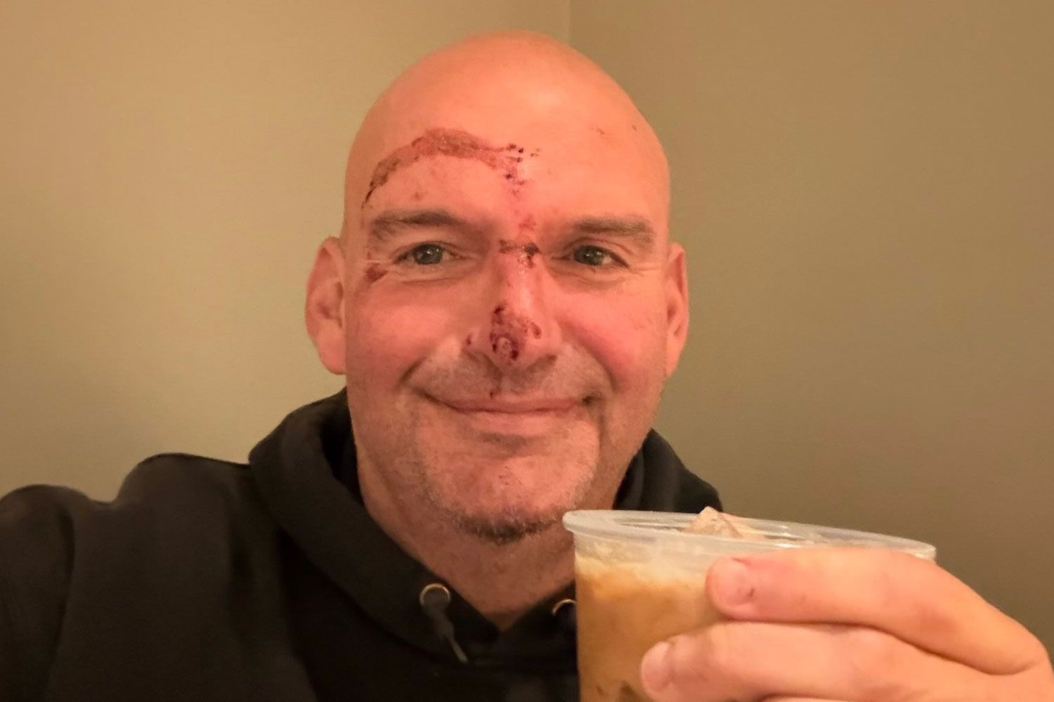 Sen. John Fetterman Shares Graphic Photo of His Injuries After Cardiac ...