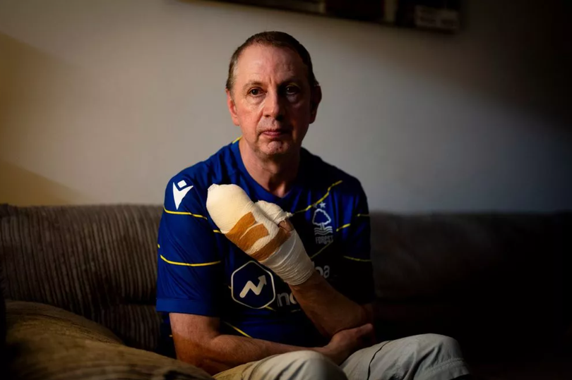 Hero of Huntingdon train attack says hand 'won't recover' after stabbing