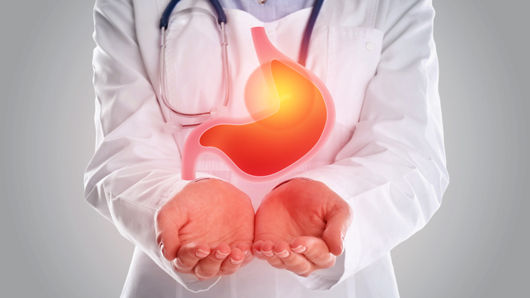 Esophageal cancer vs GERD: Symptoms, causes, and key differences