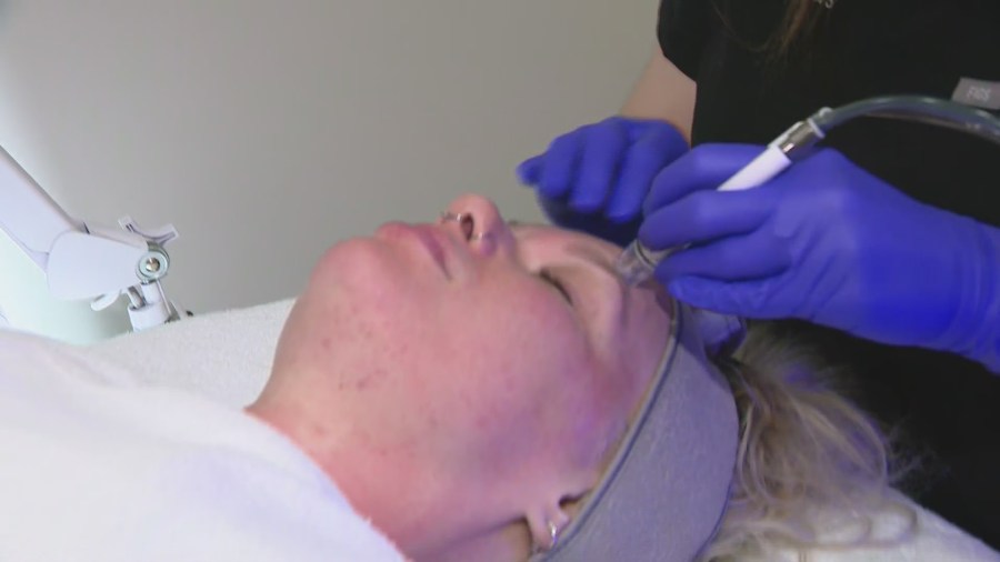 Weekend Break: Winter treatments with SpaDerma in Lincoln Park