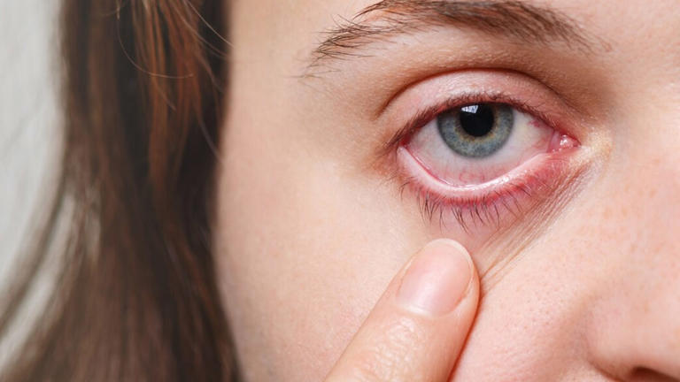 Do Northern Lights, aka Aurora Borealis, Affect Human Eyes? Expert ...