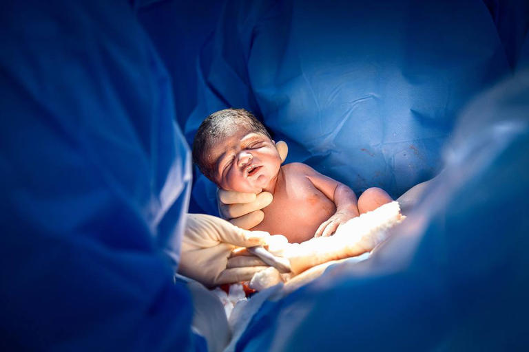 ULS do Algarve desmente encerramento da urgência em Portimão no caso do parto na A22