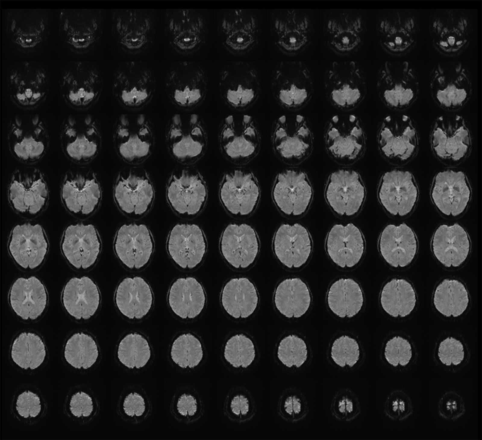 Scientist turns people's mental images into text using 'mind-captioning ...